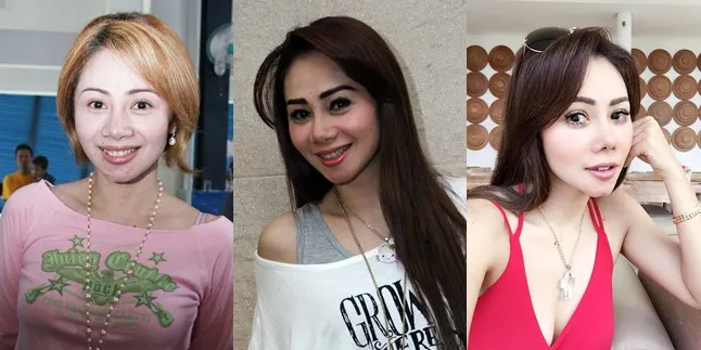 Foto Perubahan Wajah Femmy Permatasari Cantik Bikin Shock! Oplas ...