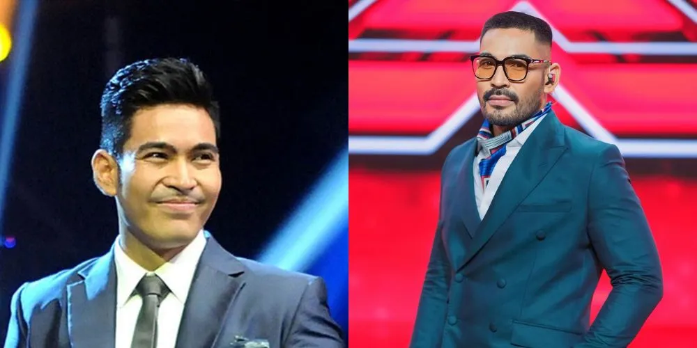 15 Transformasi Artis Sebelum Dan Sesudah Suntik Botoks Ada Yang