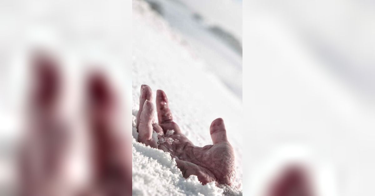 Mengenal Frostbite: Gejala, Tahap, dan Penyebabnya