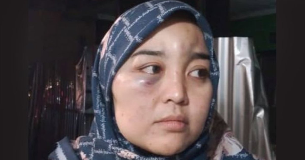 Viral Istri di Garut Diduga Dianiaya Suami hingga Luka Parah karena Dituduh Selingkuh - merdeka.com