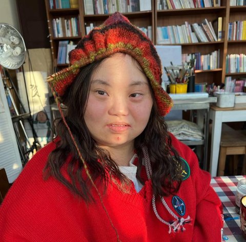 Sosok Jung Eun Hye, Aktris Korea Pengidap Down Syndrome yang Jadi Ikon ...