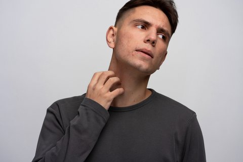 How to Get Rid of a Hickey Fast: 10 Tips to Remove Love Bites at Home ...