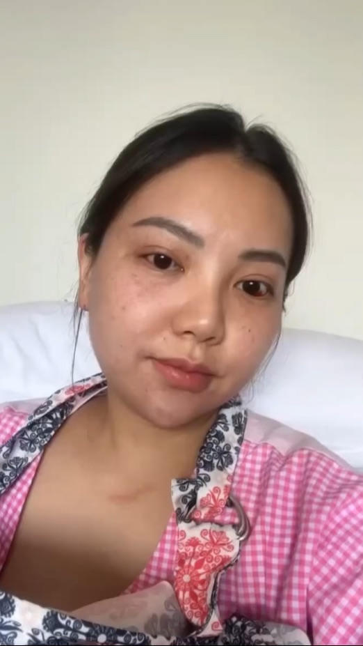 Terbaru Jessica Mila, Deretan Artis Ini Sempat Alami Pecah Pembuluh Darah