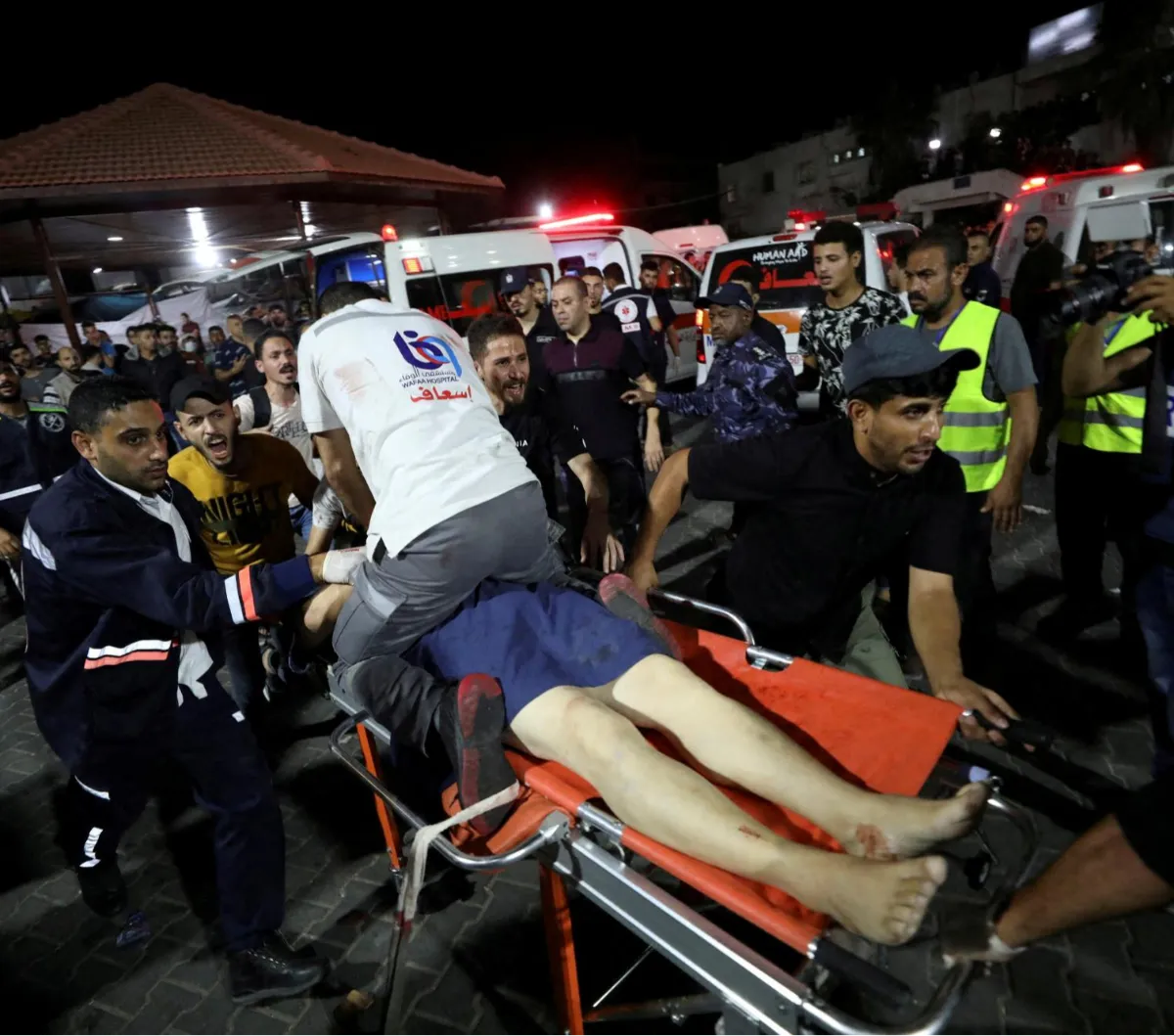 Dokter di Gaza Ungkap Kondisi Korban Kekejaman Israel Lebih Mengerikan ... Dokter di Gaza Ungkap Kondisi Korban Kekejaman Israel Lebih Mengerikan ...