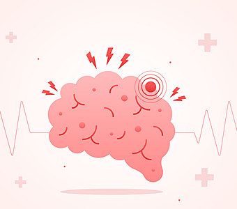 Mengenal Golden Period pada Stroke, Waktu Krusial dalam Penanganan Stroke