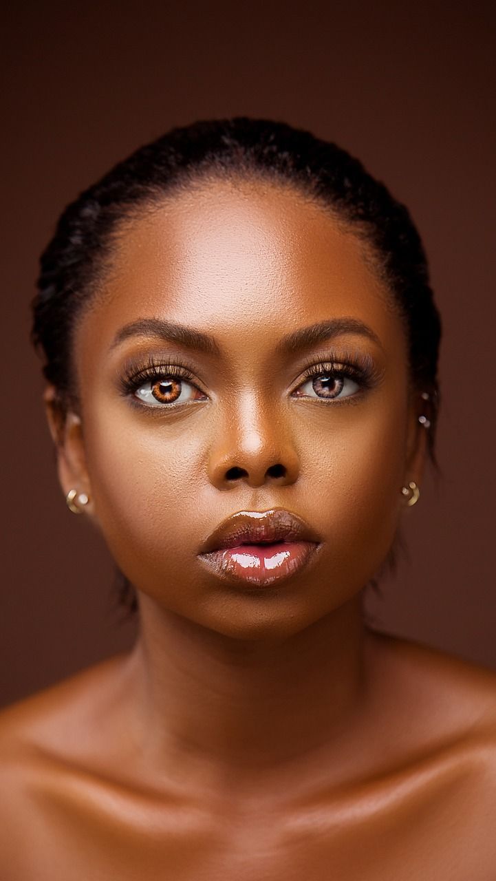 Gejala Lentigo yang Perlu Diketahui, Bercak Kulit Akibat Paparan Sinar ...