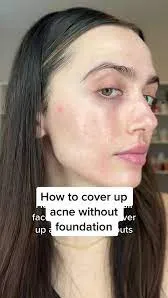 Jerawat Bukan Lagi Masalah Dengan Sandwich Makeup Method