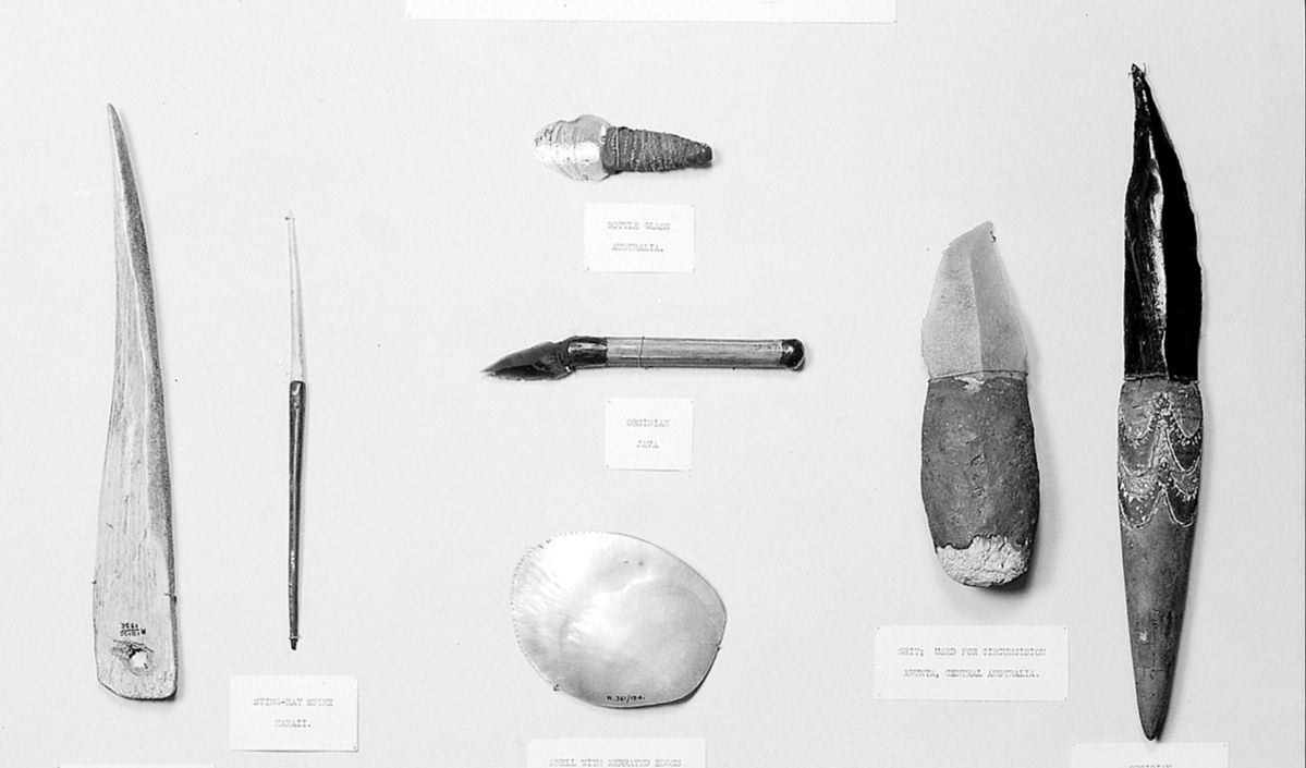 11 Metode Pengobatan Kuno yang Menyeramkan Namun Masih Diterapkan ...