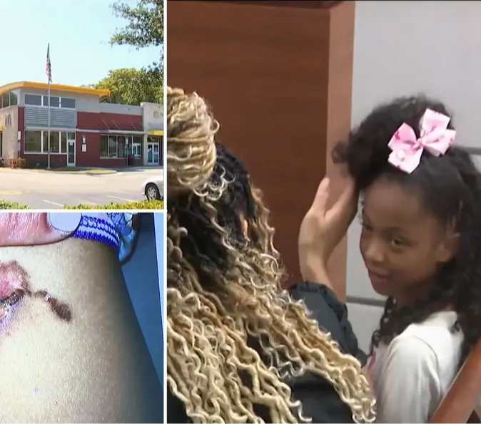 This Girl Gets $800,000 Because Injured by McDonald's Hot Nugget ...
