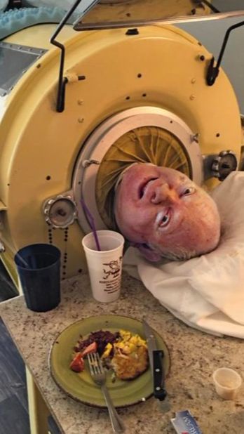 Man Has Spent 70 Years Living in An Iron Lung Machine | trstdly.com