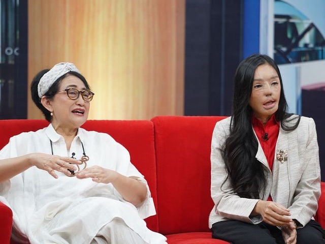 Pernah Jadi Korban KDRT Penyiraman Air Keras, Begini Kabar Terbaru Lisa ...