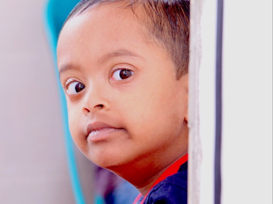 Autis adalah Gangguan Perkembangan Otak, Kenali Gejalanya