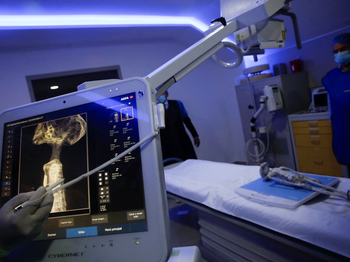 FOTO: Melihat Para Peneliti Meksiko Periksa Dua Tubuh Mumi Alien ...