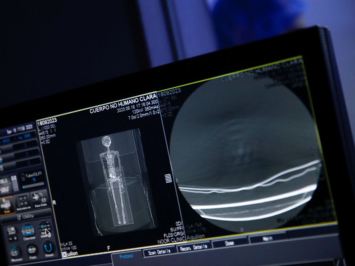 FOTO: Melihat Para Peneliti Meksiko Periksa Dua Tubuh Mumi Alien ...