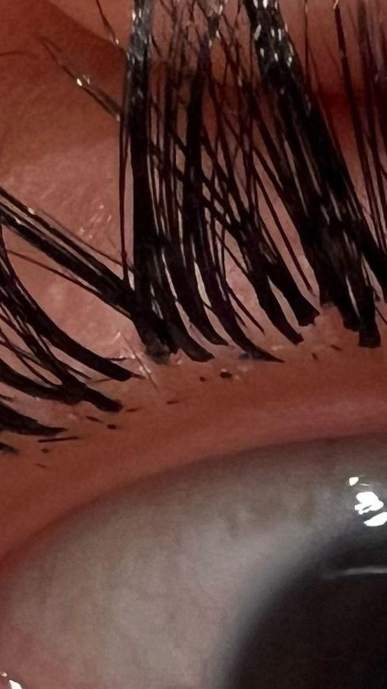 Salon Cuts Off Woman's Real Lashes When Correcting Eyelash Procedure ...
