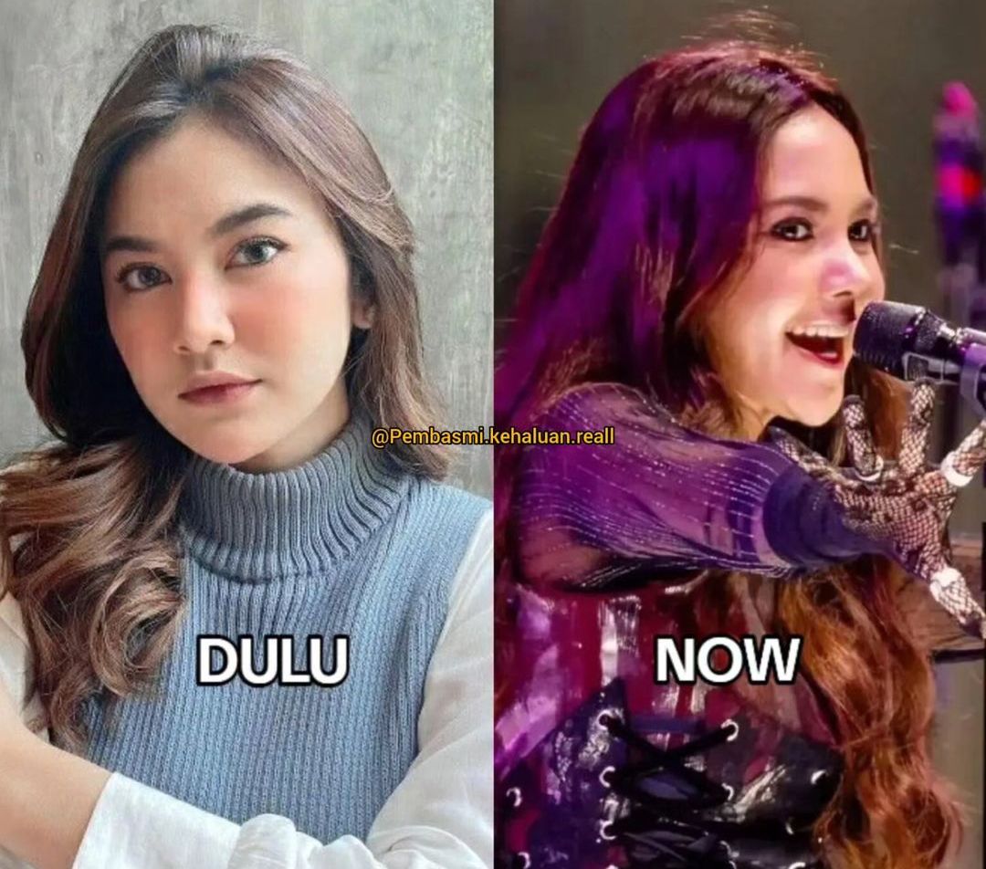 10 Artis Sebelum VS Sesudah Oplas di Tahun 2024, Mahalini Raharja ...