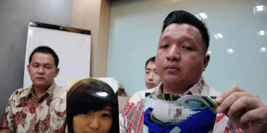 6 Cerita menyedihkan mahasiswi Binus korban penyiraman air keras ...