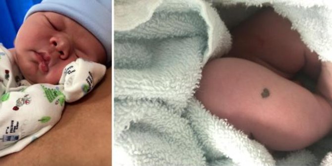Ajaib, bayi ini lahir dengan tanda hati di tubuhnya | merdeka.com Ajaib, bayi ini lahir dengan tanda hati di tubuhnya | merdeka.com