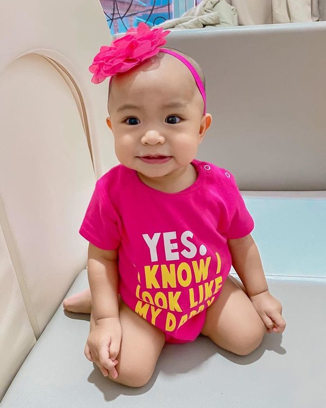 5 Potret Menggemaskan Alea, Anak Raditya Dika yang Dicukur Hingga Botak ...