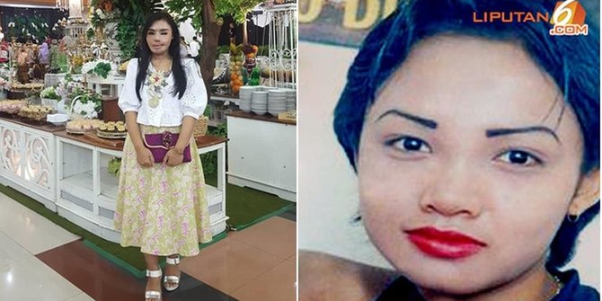 Kisah Hidup Lisa 'Face Off', Korban Siram Air Keras yang Kini Jadi ...