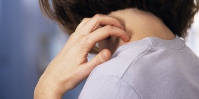 Macam-macam Penyakit Kulit dan Cara Pencegahannya | merdeka.com