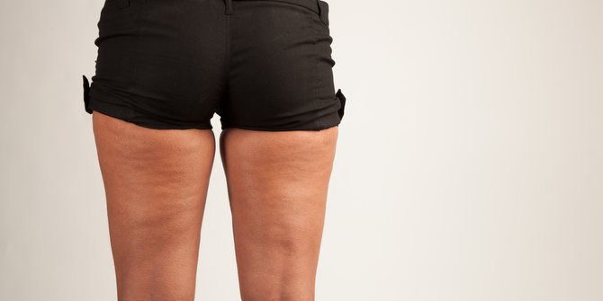 7 Jenis Makanan untuk Atasi Selulit, Salah Satunya Cokelat | merdeka.com