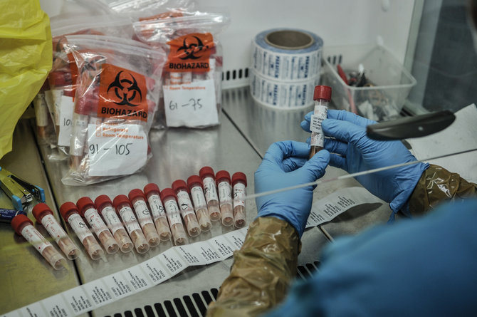 PCR Test Adalah untuk Diagnosis Covid-19, Kenali Perbedaan, Keakuratan ...