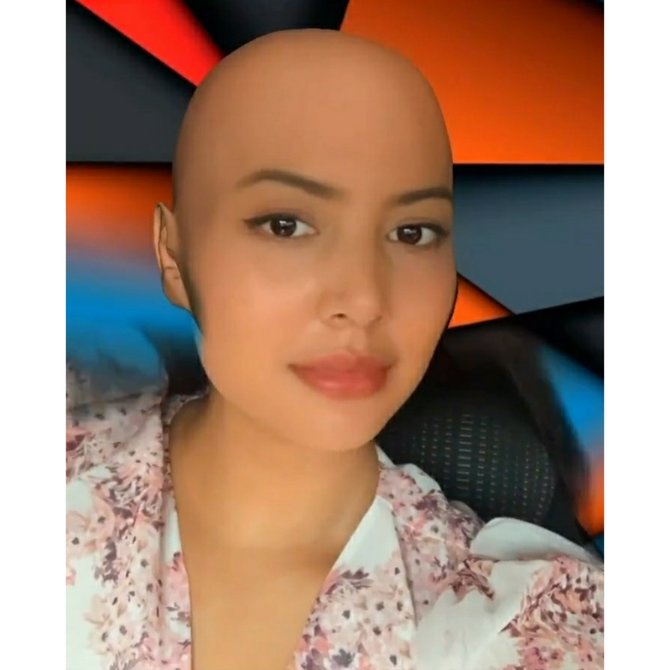 Heboh Penampilan Baru Aurelie Moeremans dengan Kepala Botak, Ini ...