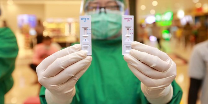 Ini Cara Memastikan Alat Rapid Test Antigen Baru atau Bekas | merdeka.com