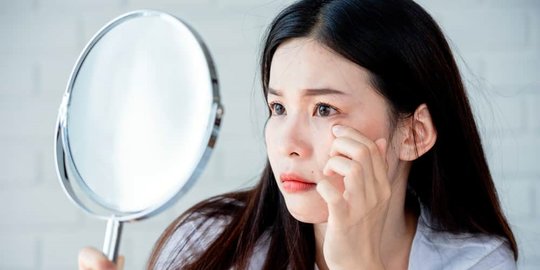 6 Penyebab Kulit Wajah Kusam Yang Sering Disepelekan Pahami Cara