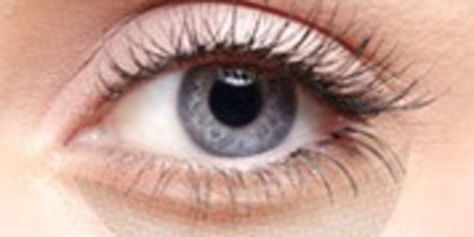 8 Cara Mengatasi Kantung Mata Ampuh dan Sederhana, Bantu Tingkatkan ...