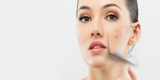 6 Penyebab Noda Hitam di Wajah, Berikut Cara Mengatasinya dengan Bahan ...