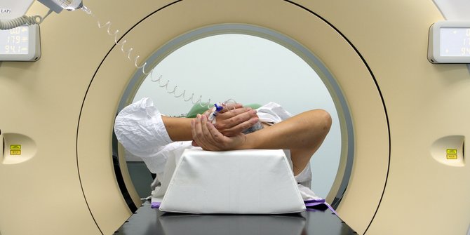 Efek Samping Terapi Radiasi yang Penting Diketahui | merdeka.com