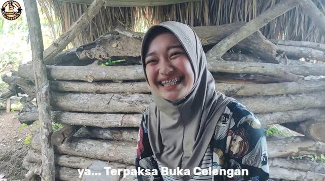 Gadis Desa Cantik Ini Rela Bongkar Celengan Demi Pasang Behel Gigi | merdeka.com