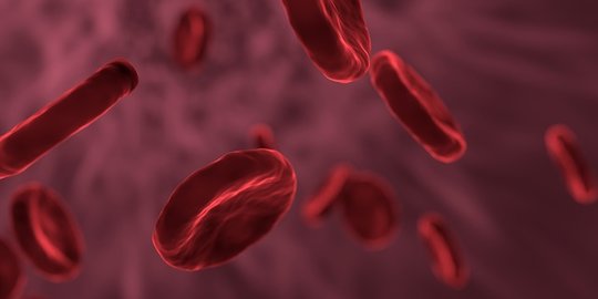 Mengenal Syok Hipovolemik, Berikut Penyebab, Gejala dan Cara ...