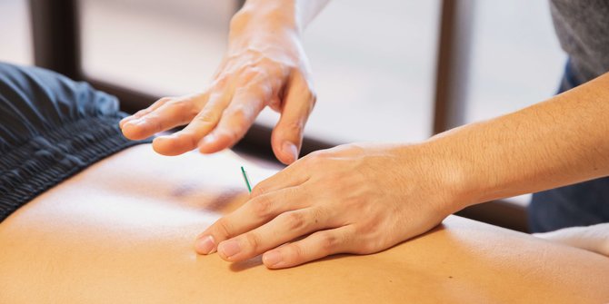 Berbagai Manfaat Metode Pengobatan Tradisional Akupuntur | merdeka.com ...