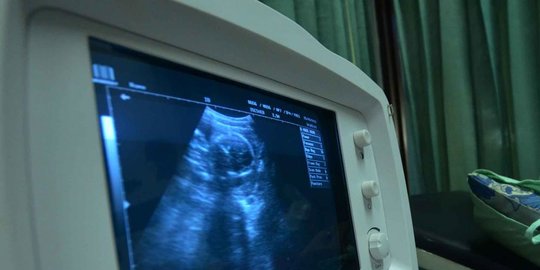 Jenis Pemeriksaan yang Perlu Dilakukan Ibu Hamil ketika Mengandung ...