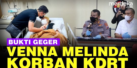 VIDEO: Sederet Bukti Geger Venna Melinda Laporkan Ferry Irawan Kasus KDRT | merdeka.com