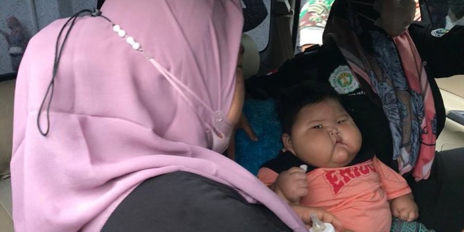 Bayi Obesitas di Bekasi Dirujuk ke RSCM untuk Penanganan Lebih Lanjut ...
