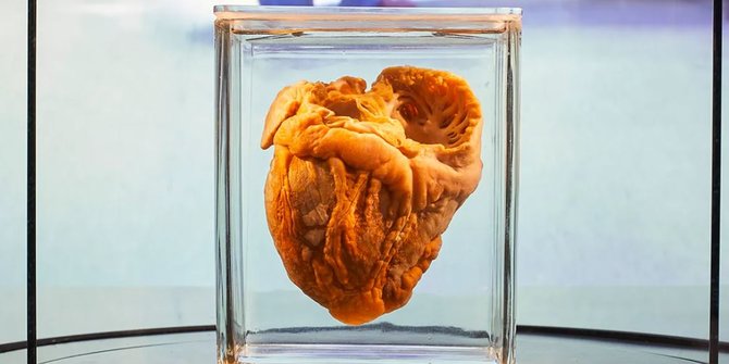 Wanita Ini Kunjungi Jantungnya yang Dipajang di Museum, 16 Tahun ...