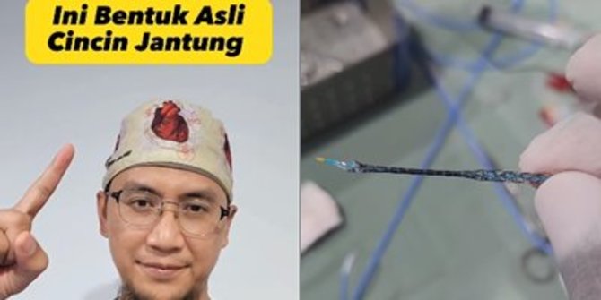 Sering Dengar Istilah Ring Jantung? Ternyata Begini Penampakannya ... Sering Dengar Istilah Ring Jantung? Ternyata Begini Penampakannya ...