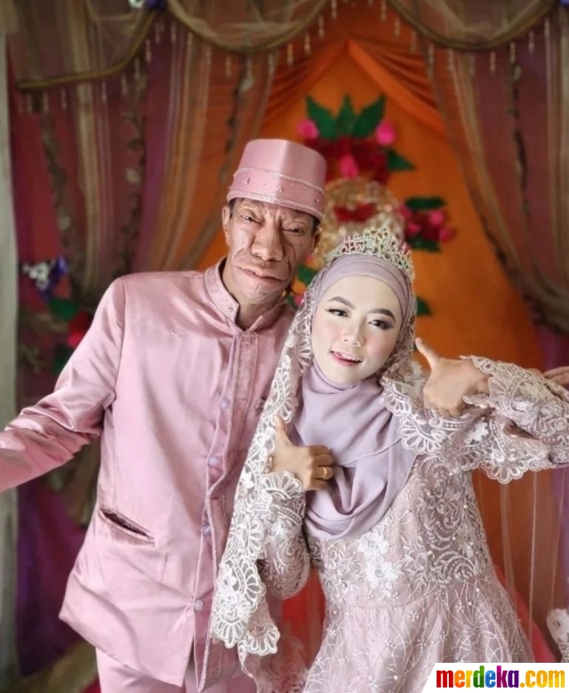 Foto : 5 Potret Shasa Puspita Dewi, Istri Surya Manurung TikToker Pengidap Sindrom Langka ...