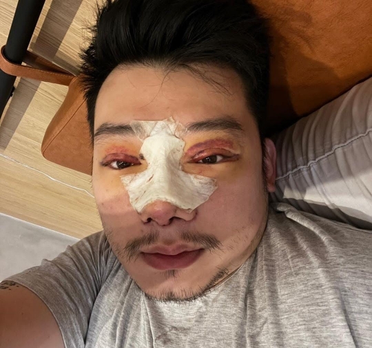 Juara MasterChef Indonesia Season 3 William Gozali Oplas, Begini Potret ...