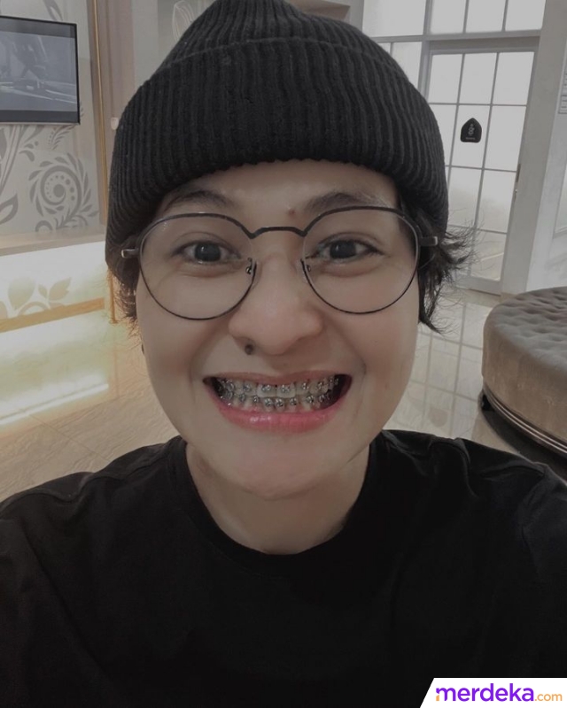 Foto : Ingat Mita The Virgin, Begini Potret Terbaru Makin Cantik Pakai Kawat Gigi | merdeka.com