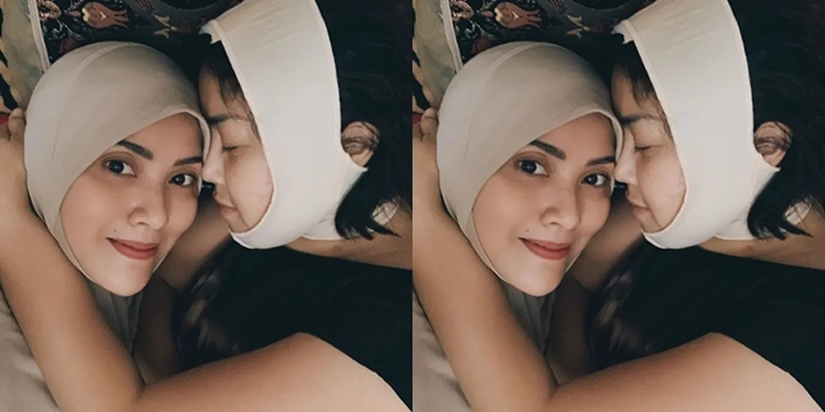 Pasang Filler 2 Tahun Lalu, Rency Milano Sempat Komplain Langsung ke ...