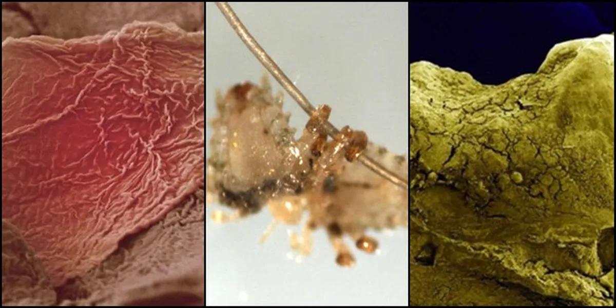 FOTO: Saat Diperbesar, Tubuh Manusia Jadi Ngeri! Bisa Kamu Tebak ...