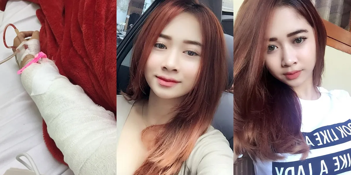Ini Foto-Foto Intan Novita, Gadis Cantik Korban Siraman Air Keras ...