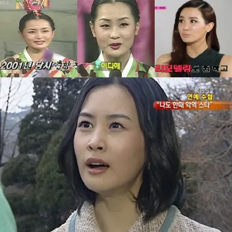Lee Da Hee Plastic Surgery