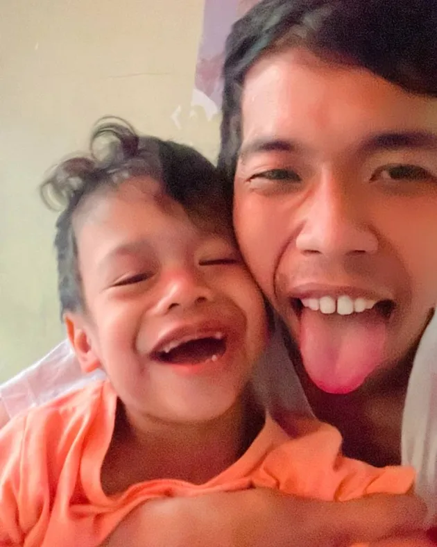 8 Potret Anak Kedua Dede Sunandar Menderita Penyakit Langka, Akui ...