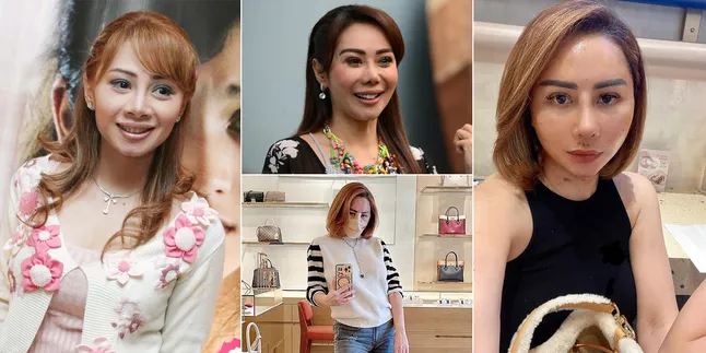 11 Photos of Femmy Permatasari's Face Transformation from the Past to ...